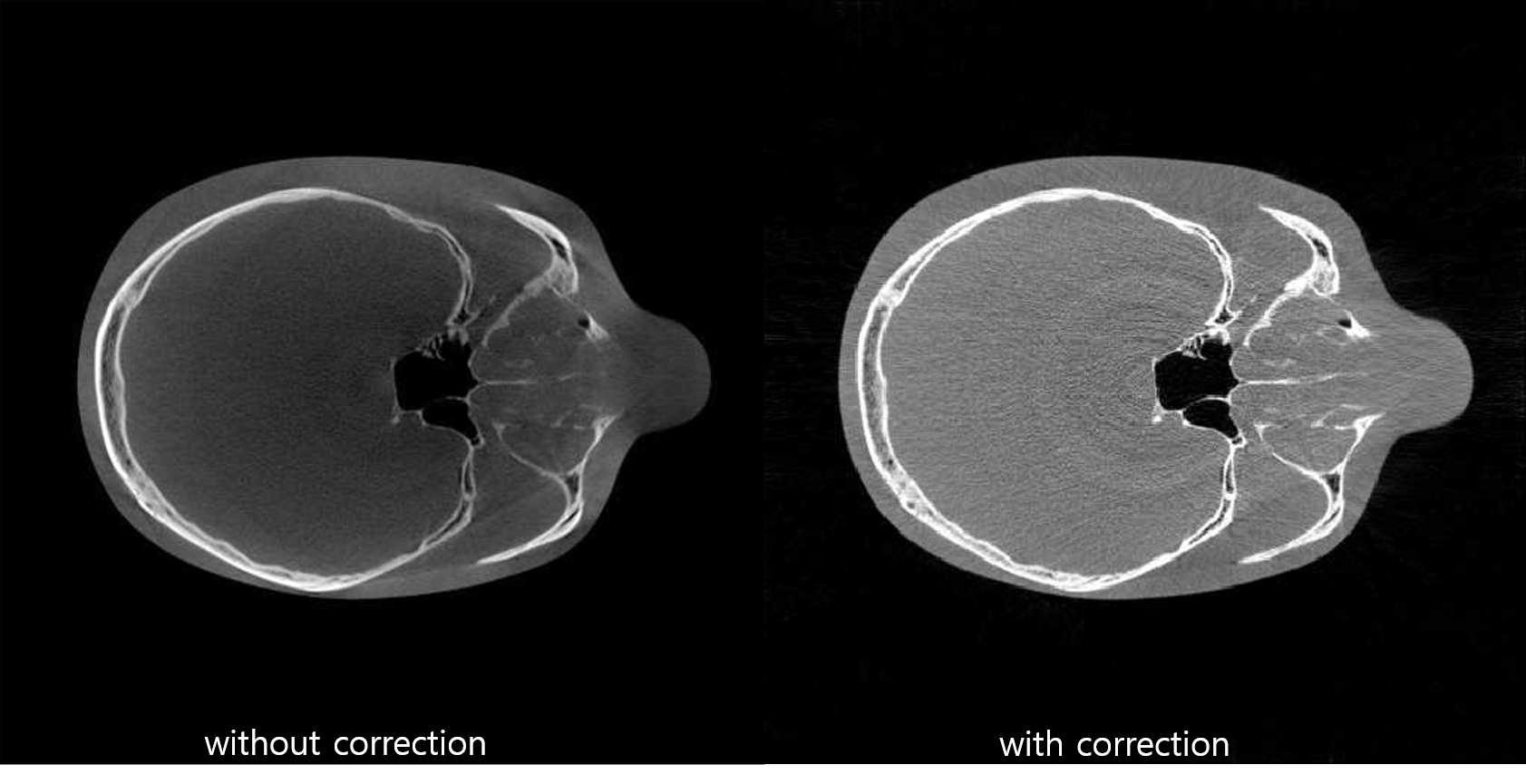방사선의학 웹진